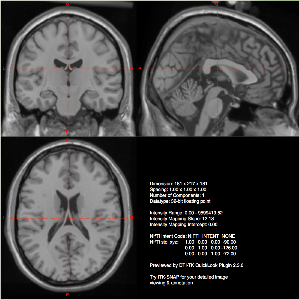 A beginner’s guide to shape analysis using Deformetrica | by Benoit ...