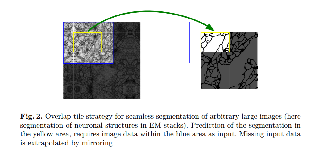 Semantic segmentation- UNet. UNet | by Abhishek Kumar | Medium