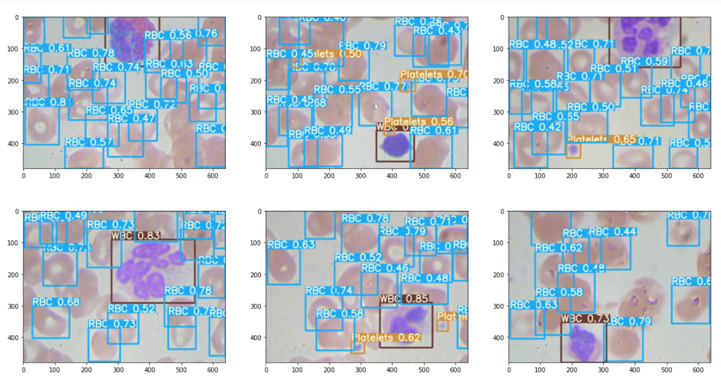 Yolo V5 Object Detection On A Custom Dataset By Balakrishnakumar V