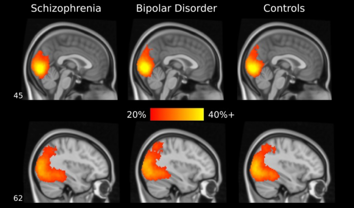 A Brief Introduction To Functional Connectomics By Mikey Taylor The Startup Medium