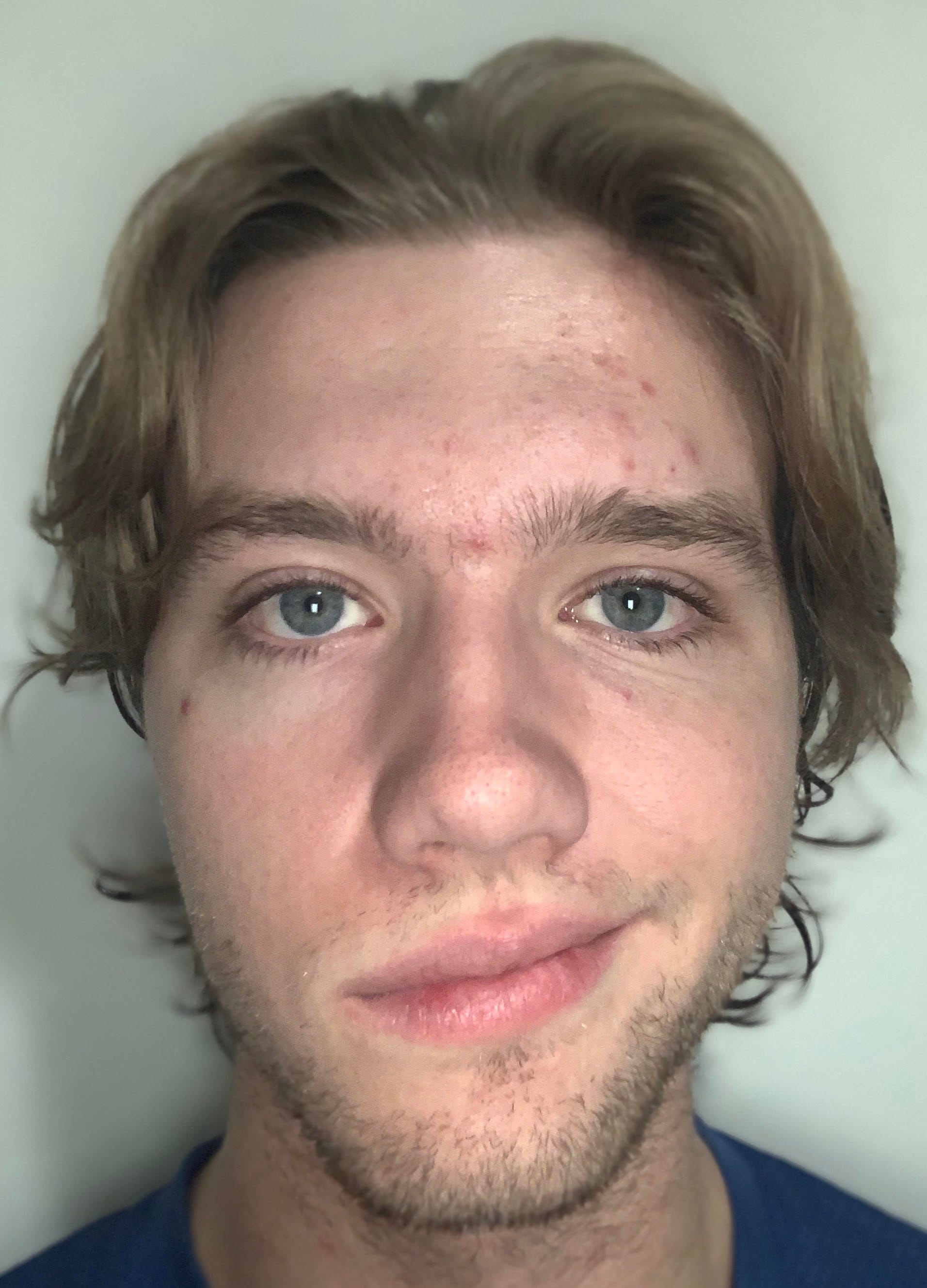 Zachary May – Medium