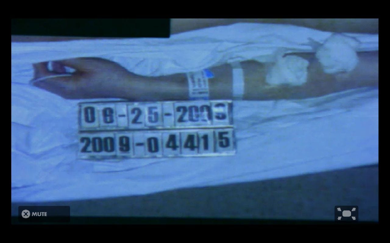 What did Michael Jackson suffer from and how he died? | by Dark Energy ...
