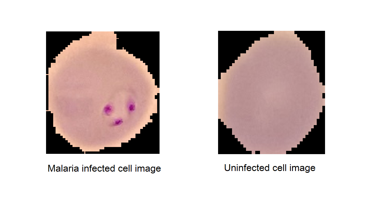 Github Soham1024 Malaria Cell Image Classification Using Cnn
