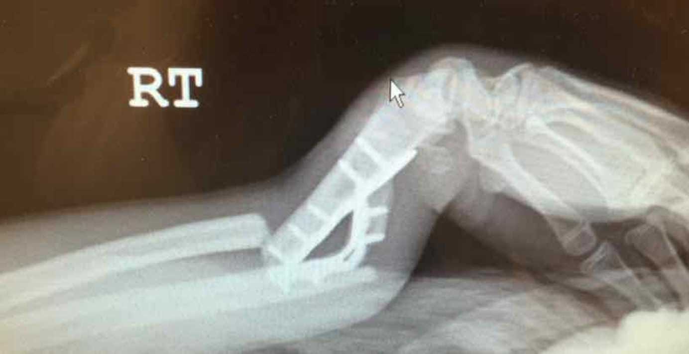 A fall that’s all in the wrist - Figure 1 - Medium