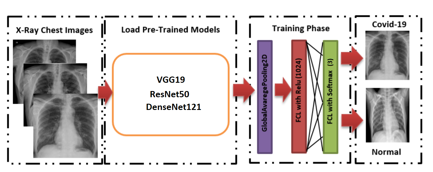 Lung Disease Classification with Explainable AI | by Asad | Jul, 2020 ...