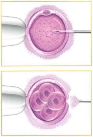 Laser Assisted Embryo Hatching. Laser Assisted Hatching India | by ...