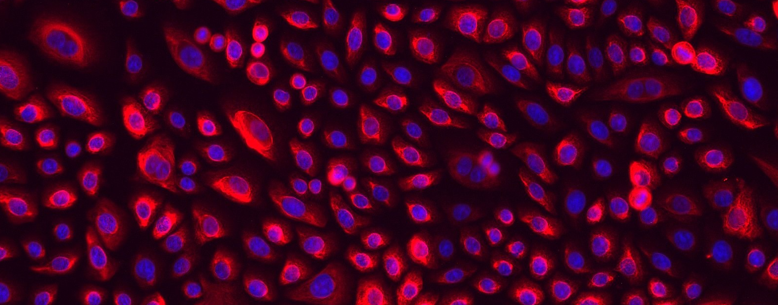 GitHub - RishitToteja/Cervical-Cancer-Prediction-Using-Machine-Learning