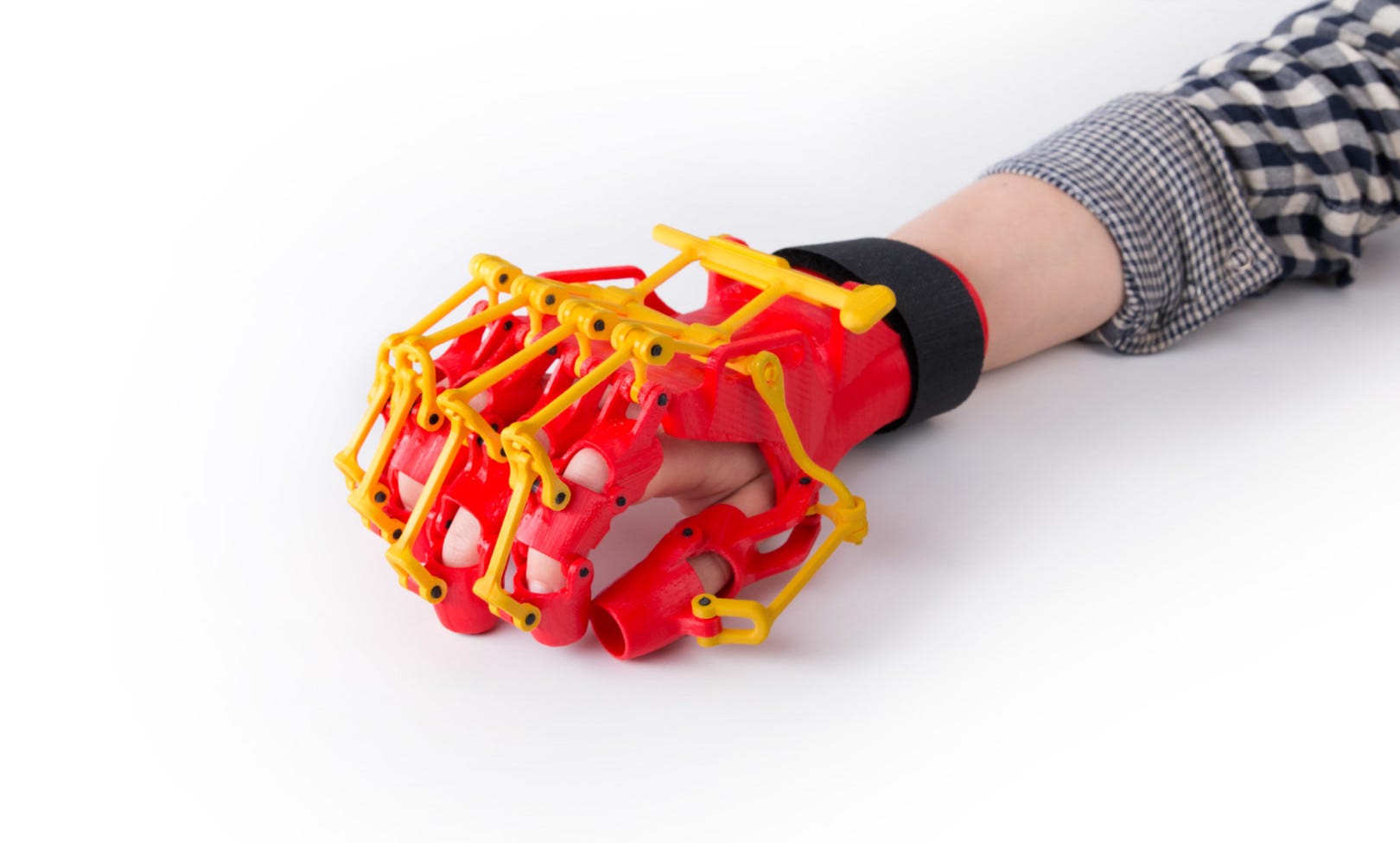 The Making of a 3D Printed Rehabilitation Orthosis | by Zmorph SA | Medium