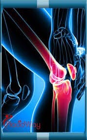 Female Knee Replacement Q & A’s. Q. What is the Gender solutions knee ...