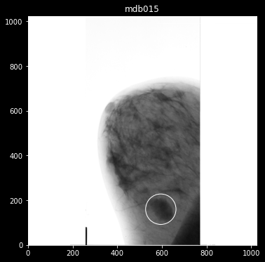 Using Deep Learning for Mammography Classification | Analytics Vidhya