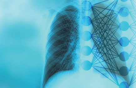 A WEB-BASED MODULE FOR IDENTIFICATION OF PNEUMONIA USING DEEP LEARNING ...