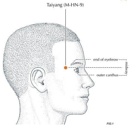 My Chinese Medicine Story.. Acupuncture changed my life ! | by Pillar ...