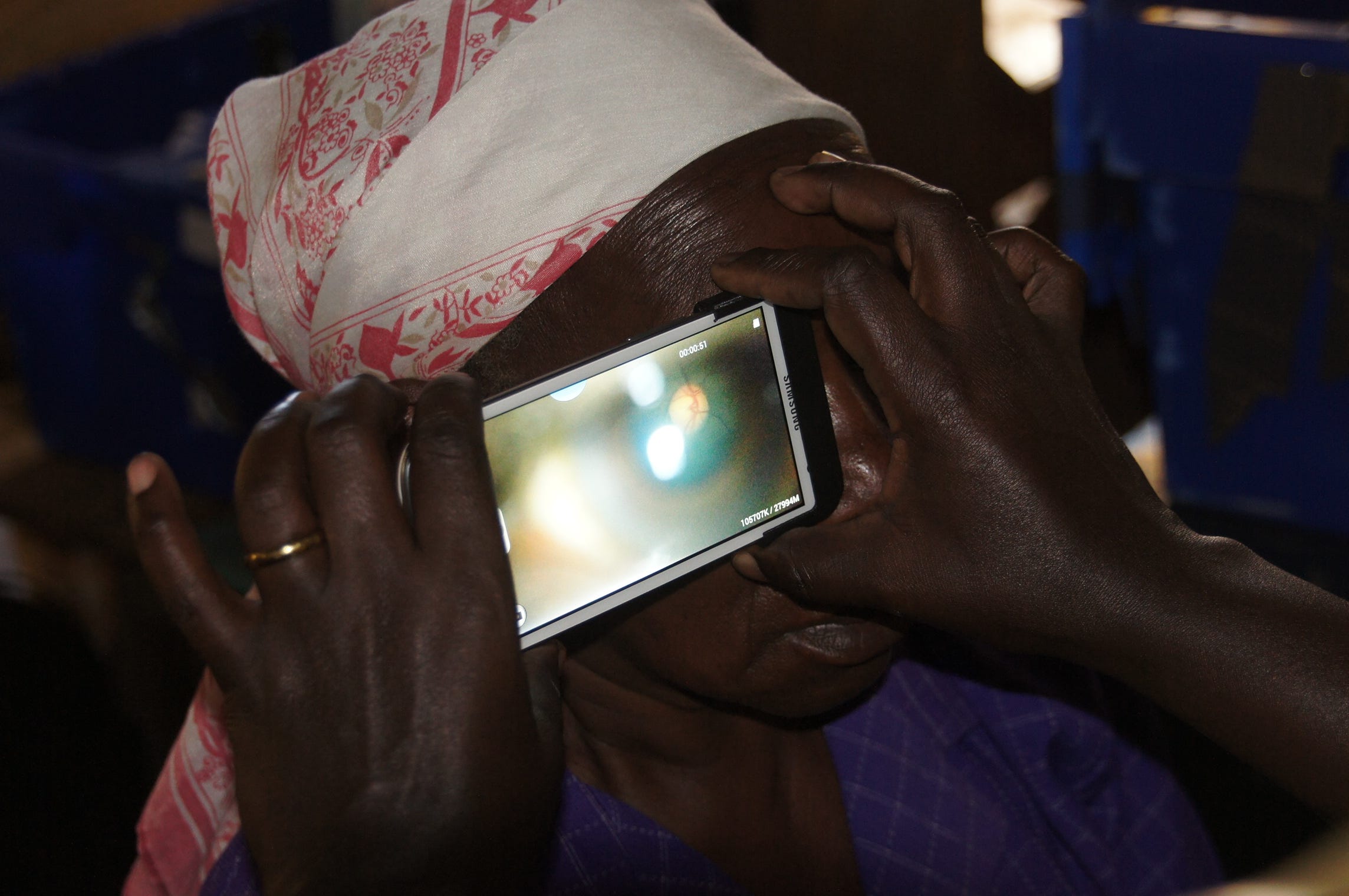Peek Retina: a journey from idea to impact | by Peek Vision | Peek ...