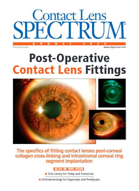 Best Contact Lenses and general practitioner Lenses on-line | by ...