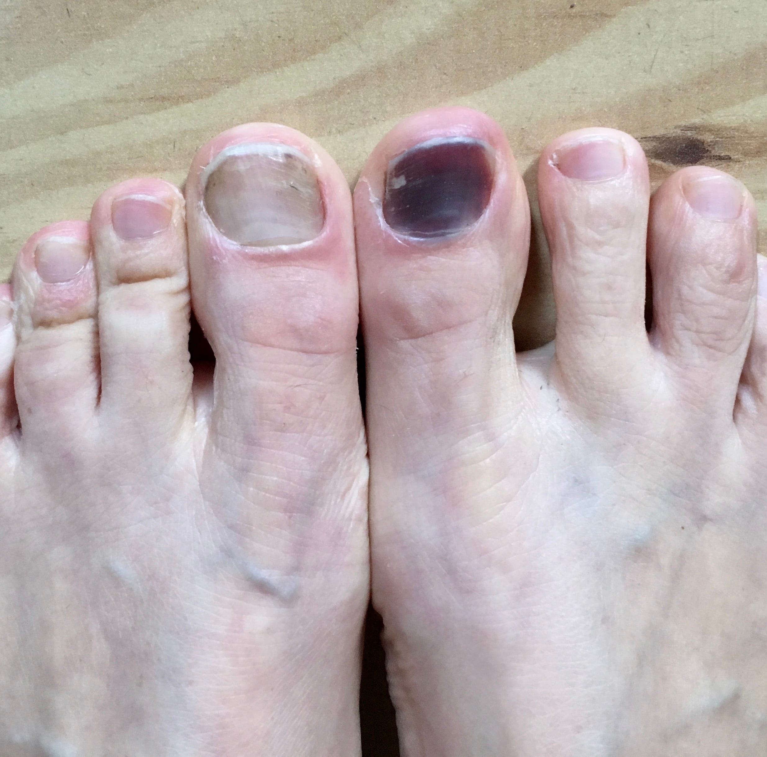 Why ‘Again’?. I’ve been on this ‘get it dyed/grow it… | by Jane Milne ...