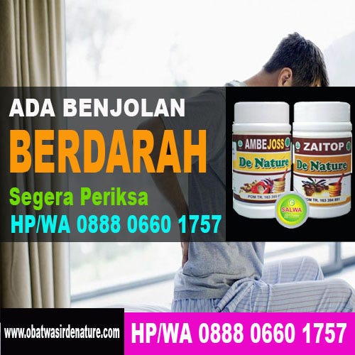 Ambeien Stadium 3. Penyakit wasir atau ambeien tentu sudah… | by ...