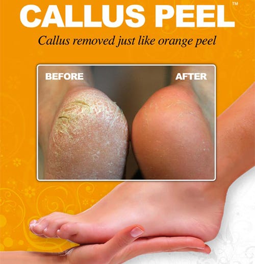 Rejuvenate Your Feet with the Appropriate Care They Deserve — Callus Peel | by Beauty Heaven ...