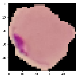 Infected Malaria Cell Image Classification using Convolutional Neural ...