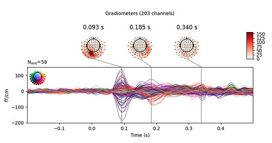 Visualizing Brain Waves with Python | by Cole Hagen | Digital health ...