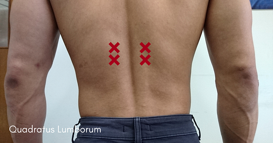 How To Identify Your Muscle Knots (And Where To Find Them) | by ...
