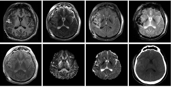 Art around a 7 Tesla MRI Scan. Our 7 Tesla friend | by Virginia ...