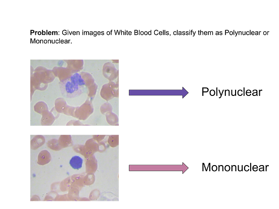 Classifying White Blood Cells With Deep Learning (Code and data ...