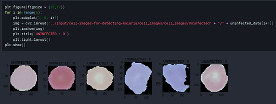 Malaria Detection in Blood Sample Images using Deep Learning | by ...