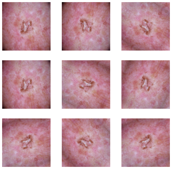 Skin Cancer Detection Using Convolutional Neural Networks | by Adhithia ...