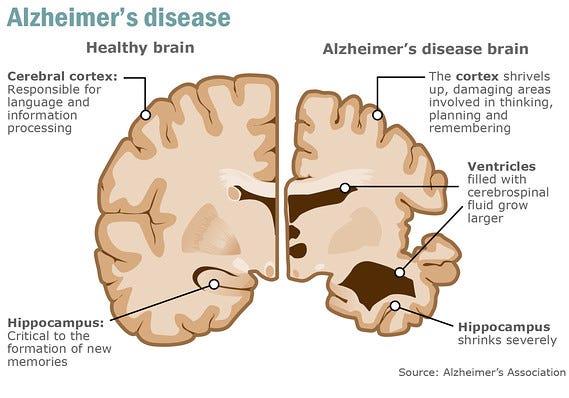 Insulin, Diabetes, and Alzheimer’s | by FUDteam | Medium