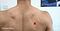 How To Identify Your Muscle Knots (And Where To Find Them) | by ...