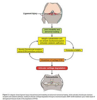 Knee Osteoarthritis: What Is It and How Do I Manage It? | by ...