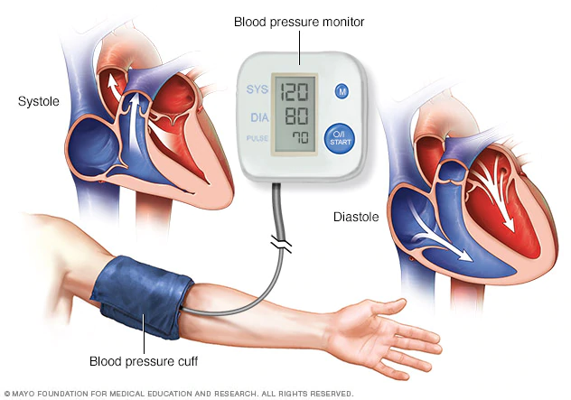 How To High Blood Pressure Control Plan By Sr Shumon88 Medium