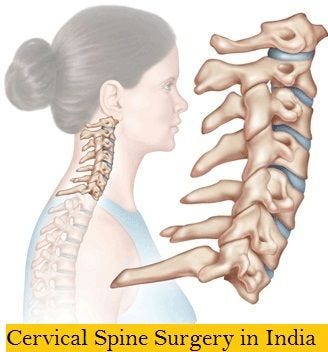 Why is Cervical Spine Surgery in India required? | by Spine Surgery ...