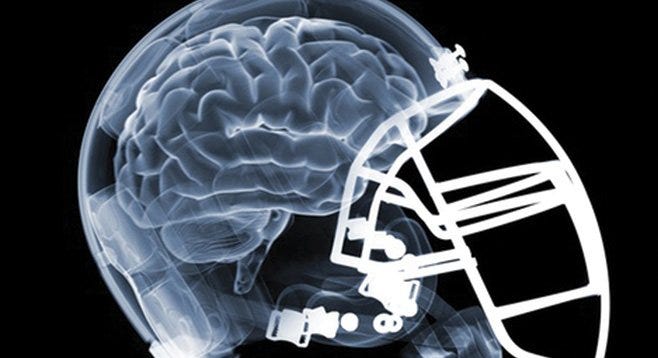 Neurological Consequences of Playing Football; What Are We Doing to ...