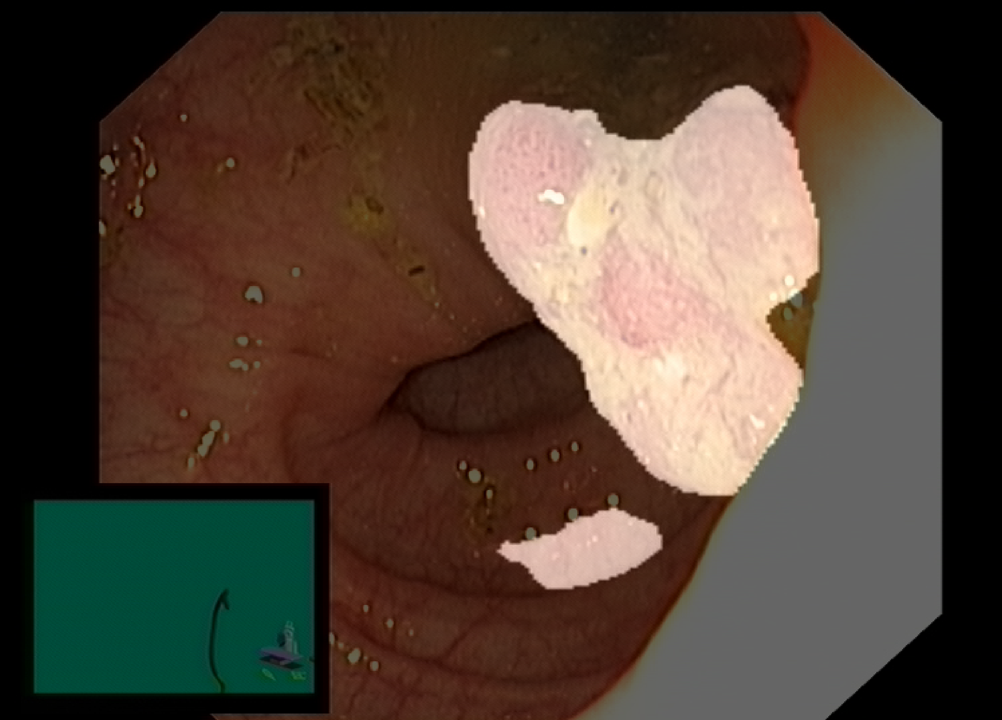 From cats and dogs to polyps in the colon | by Bjørn-Jostein Singstad ...