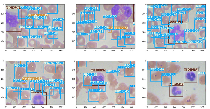 Yolo V5 Object Detection On A Custom Dataset Deepscopy