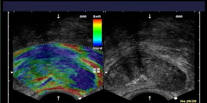 Global Color Ultrasound Market 2019 — Qualitative Analysis, Product ...