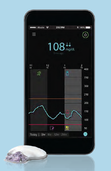 The CGM Wars — MEDTRONIC GUARDIAN CONNECT VS ABBOTT FREESTYLE LIBRE ...