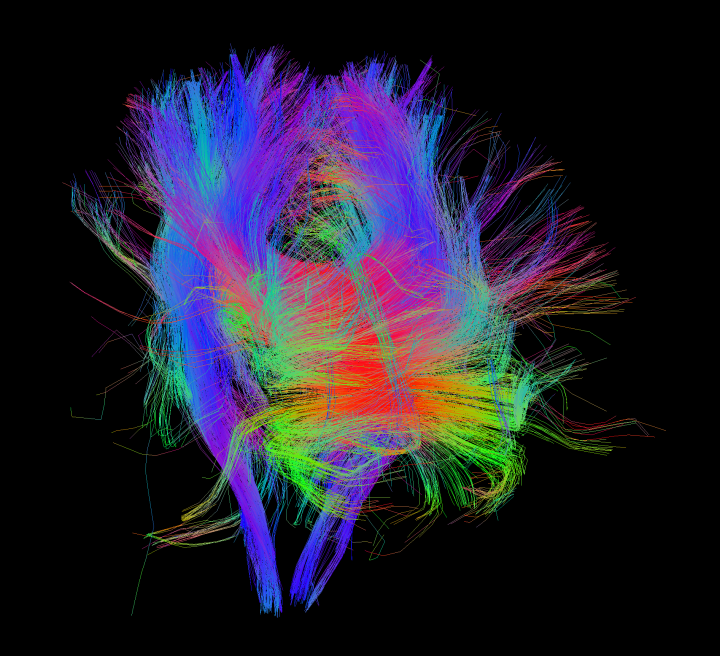 Digitizing human consciousness. The brain is a computer at its core ...