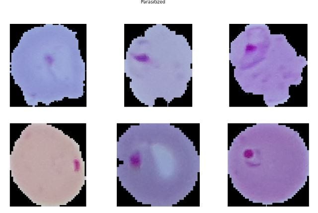 Malaria cell detection using Convolution Neural Networks (CNN) | by ...