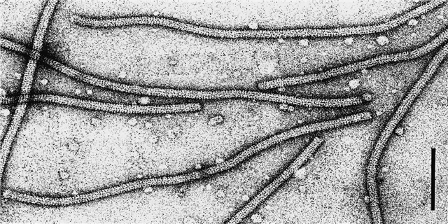 Potato Virus X & Y. Potato viruses impacts crop by a… | by Shrish Tariq ...