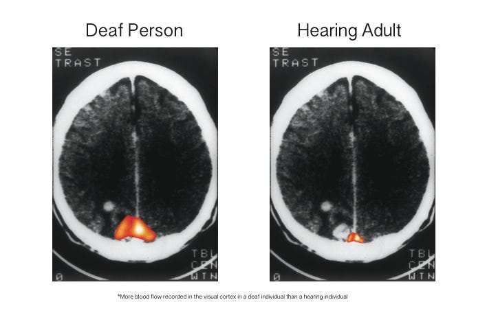 Human Echolocation: A possible solution for age-related deterioration ...
