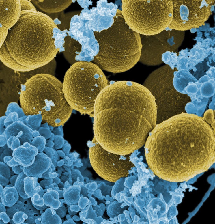 Microbes 101: Bacteria. When most people think of microbes… | by ...