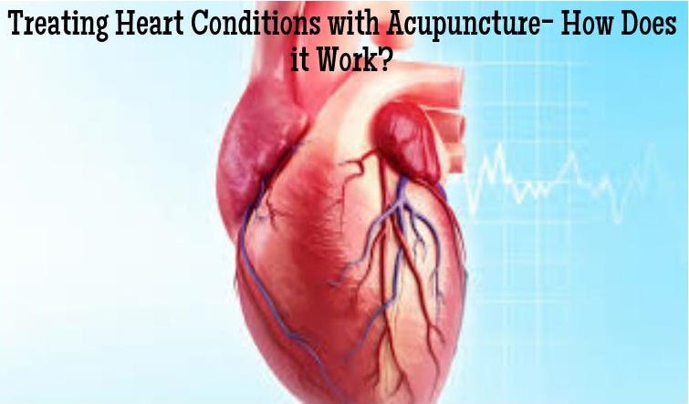 Treating Heart Conditions with Acupuncture- How Does it Work? | by Dr ...