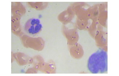 OpenCV: Count of Objects in Blood Image with Python | by Amit Chauhan | The Pythoneers | Medium