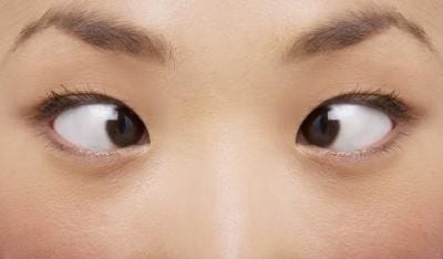 8 Simple Eye Exercises To Keep Your Eyes Healthy | by Sherri C. McManus ...