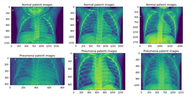 A WEB-BASED MODULE FOR IDENTIFICATION OF PNEUMONIA USING DEEP LEARNING ...
