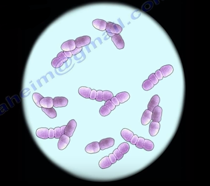 Clostridium Bacteria. Clostridium is a gram-positive rod… | by Nabil ...