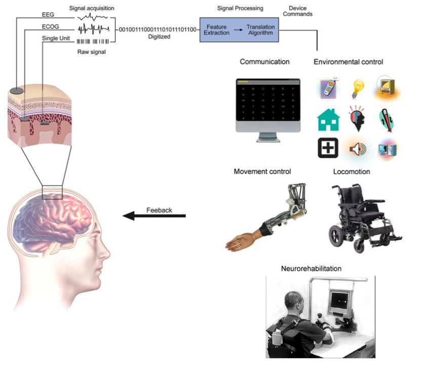 Brain Computer Interfaces — Overview | by Julian Di Felice | Medium