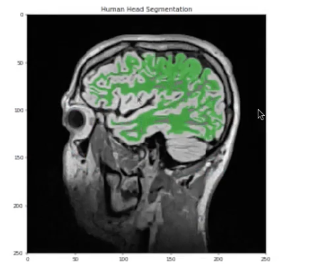 Practical OpenCV 3 Image Processing with Python | by Riaz Munshi | Medium